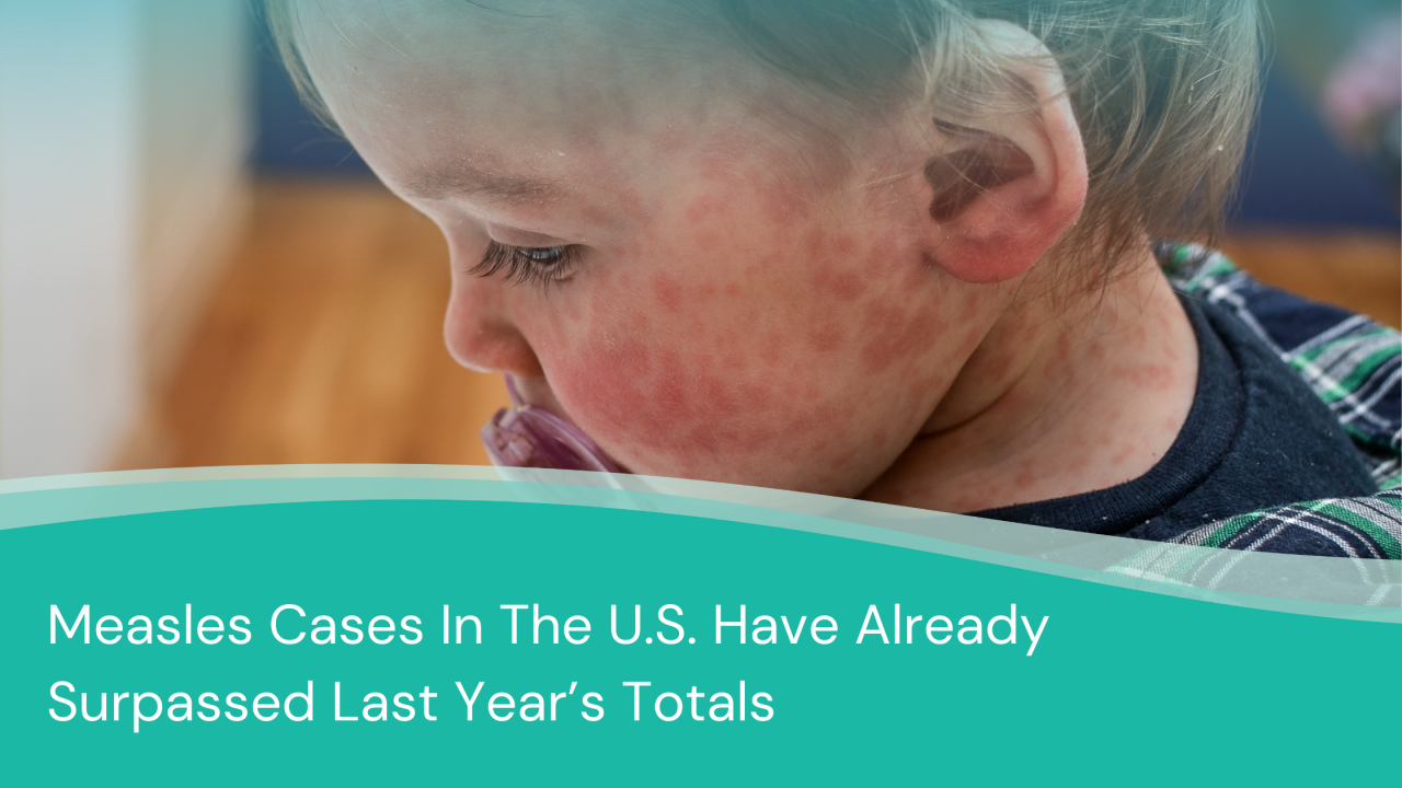 Measles Cases On The Rise In The U.S. - JASE Medical